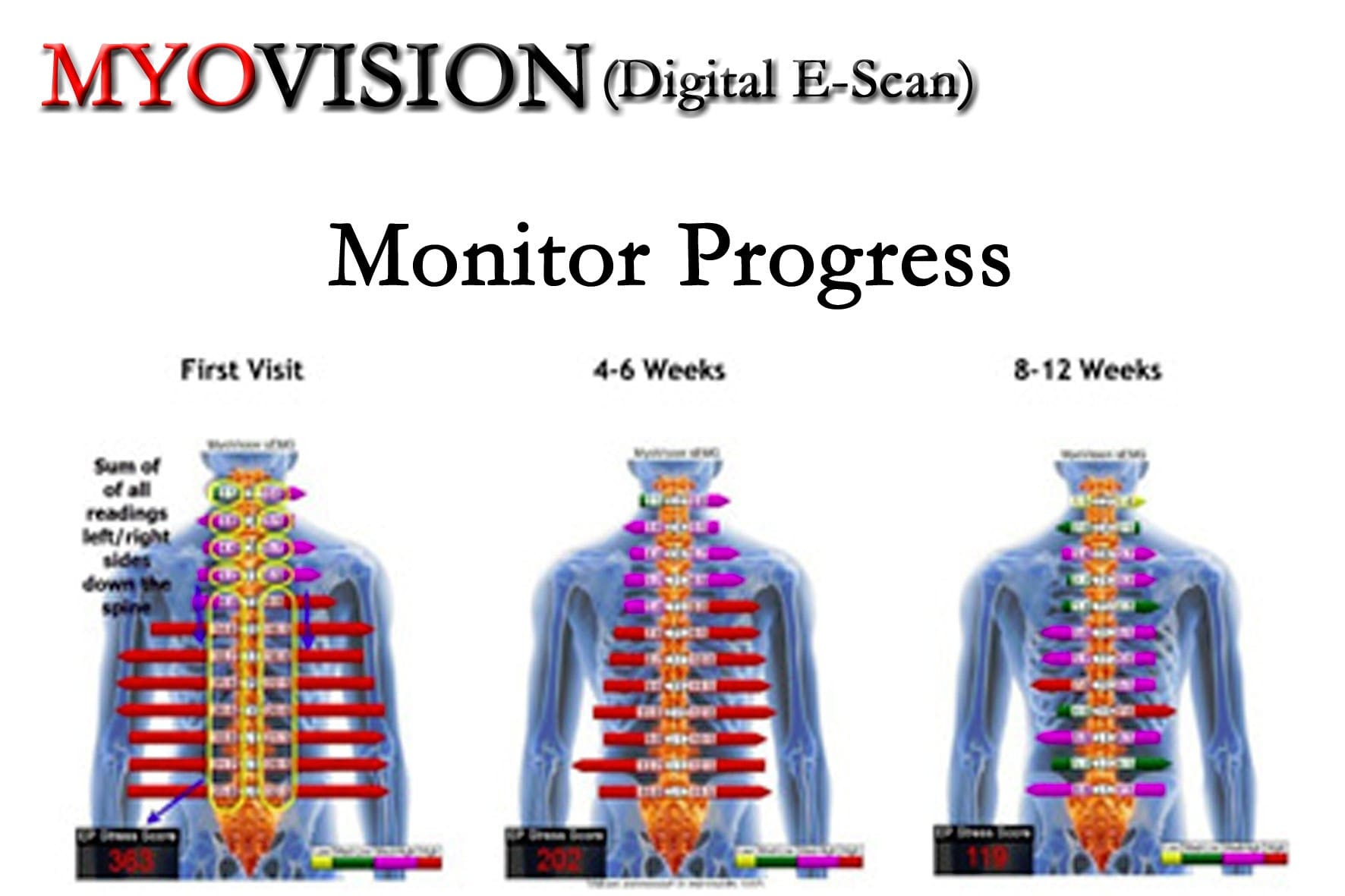 SPINAL HEALTH CHECK (MyoVision + PostureScreen) & FREE CHIROPRACTIC ...